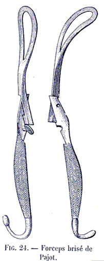Forceps brisé de Pajot