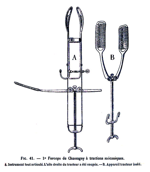 Forceps de Chassagny à traction mécanique