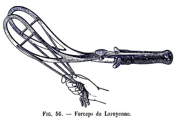Forceps de Laroyenne